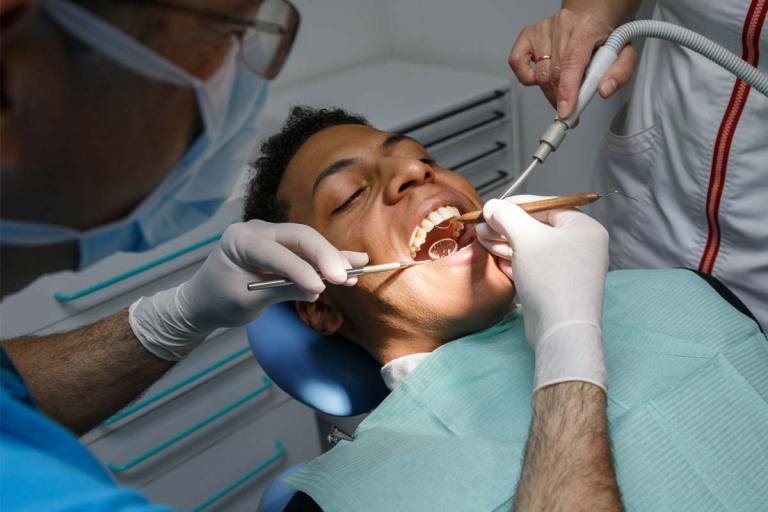 Selante Dental: O que é e como aplicá-lo?