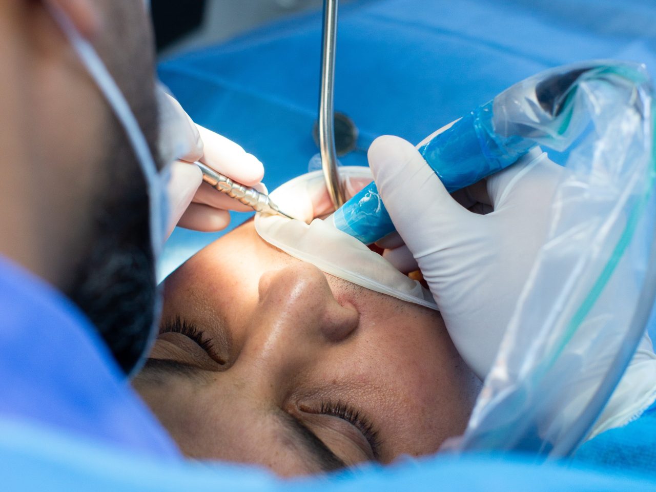 Abscesso Dental: O que é, Causas e Tratamento