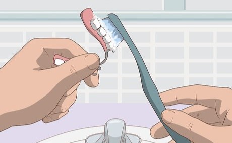 Prótese Parcial Removível (PPR): Para que serve?