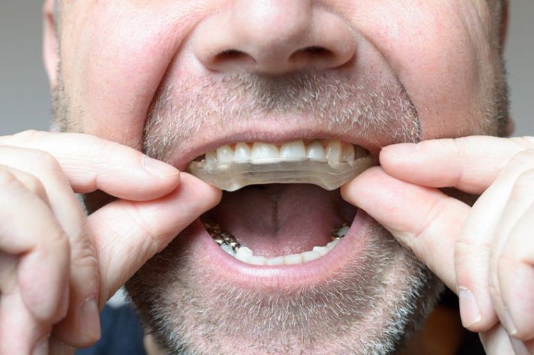 15 Problemas Bucais Mais Comuns e Como Evitá-las